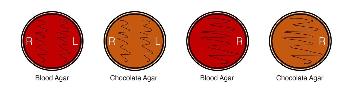 Guide to Direct Inoculation of Ocular Specimens | Diagnostic Laboratory ...